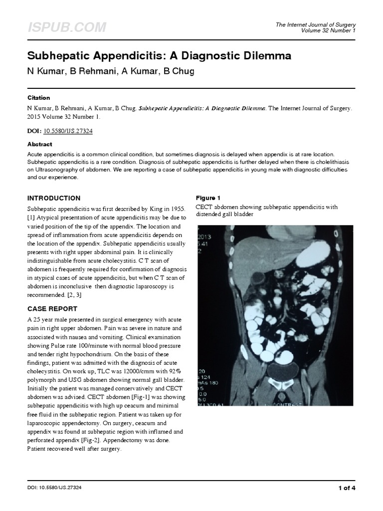 Subhepatic Appendicitis - A Diagnostic Dilemma | PDF | Digestive ...