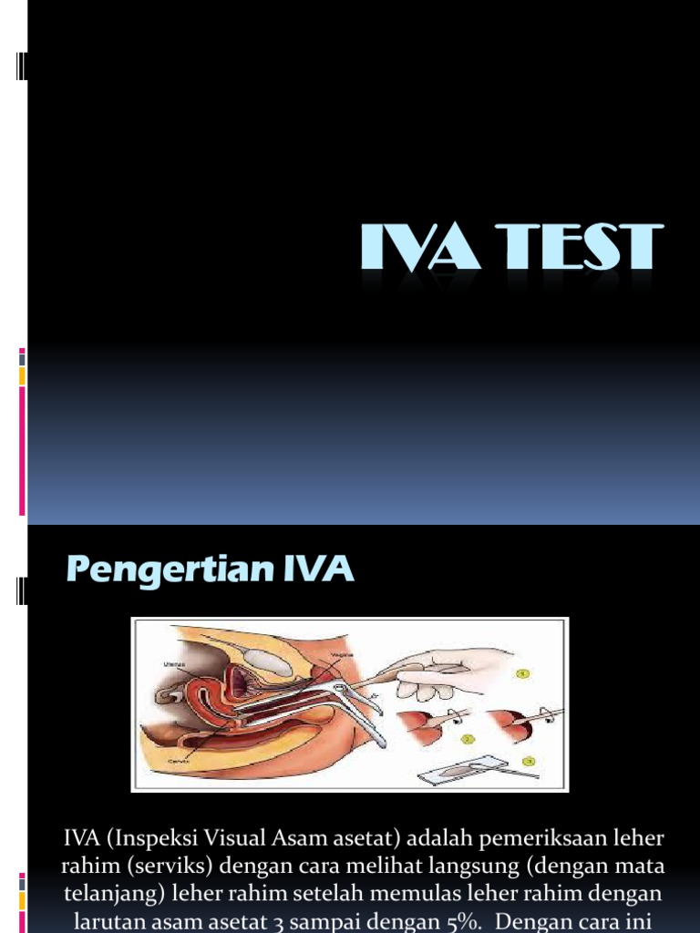 Iva | PDF