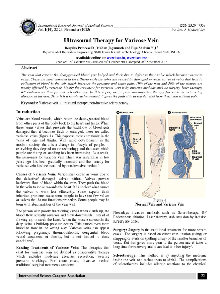 Jurnal Varises | PDF | Medical Ultrasound | Varicose Veins