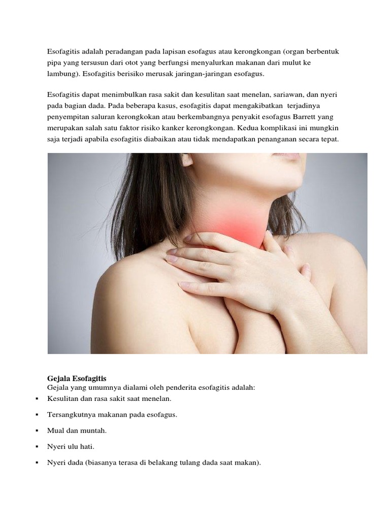 Esofagitis | PDF