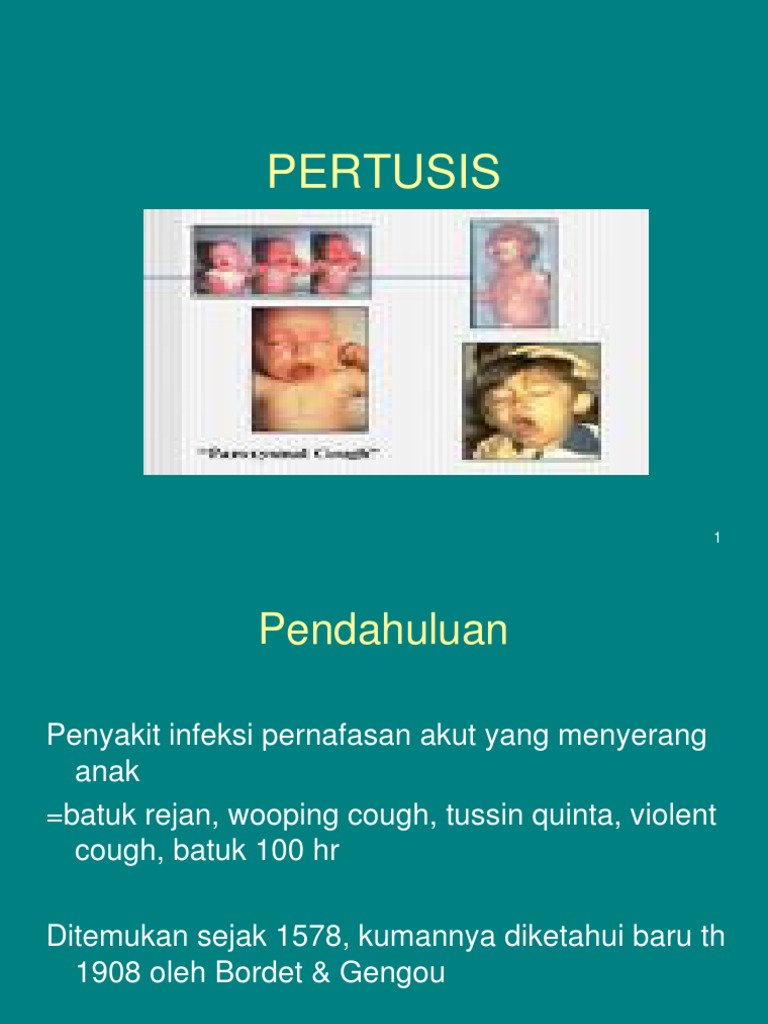 Pertusis | PDF