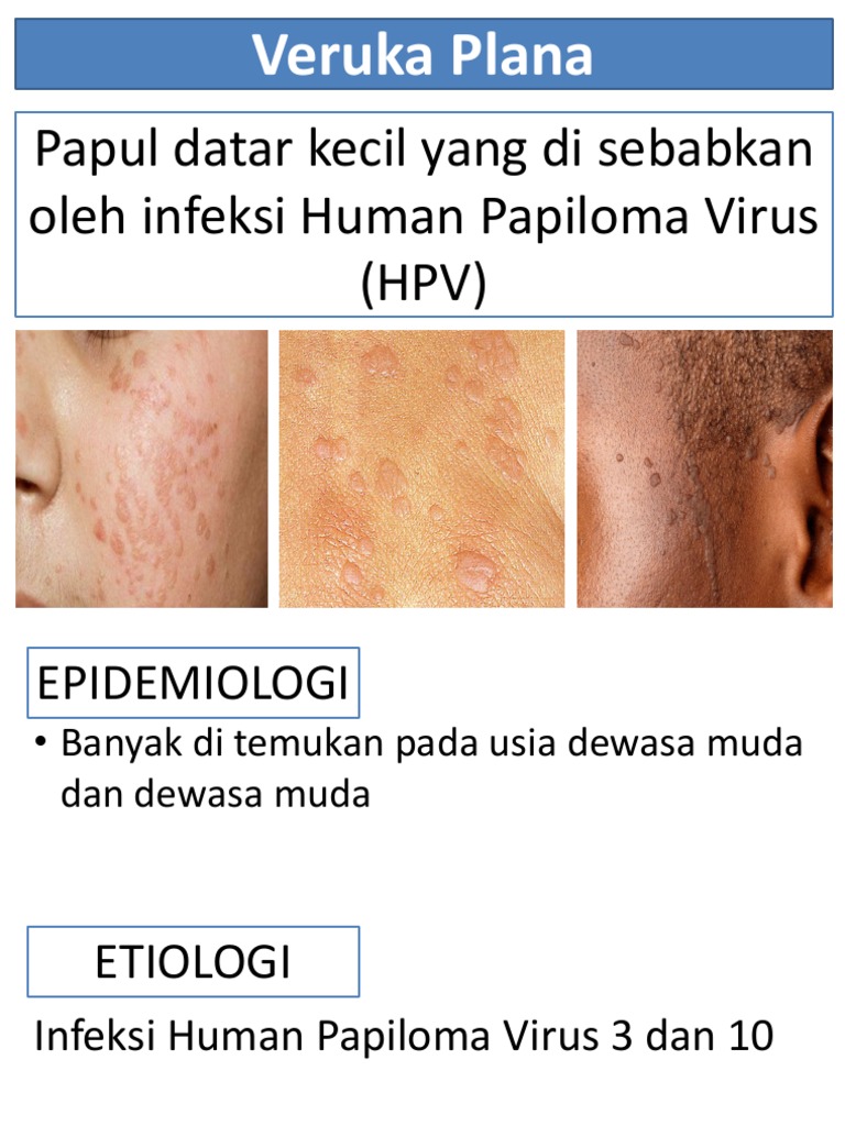 Veruka Plana Dan Veruka Vulgaris | PDF