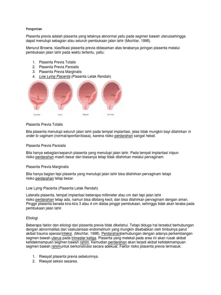Plasenta Previa | PDF