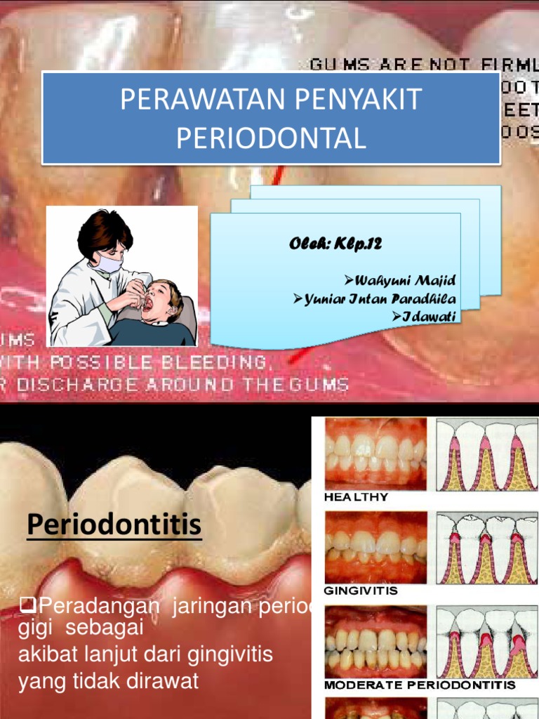 Perawatan Penyakit Periodontal | PDF