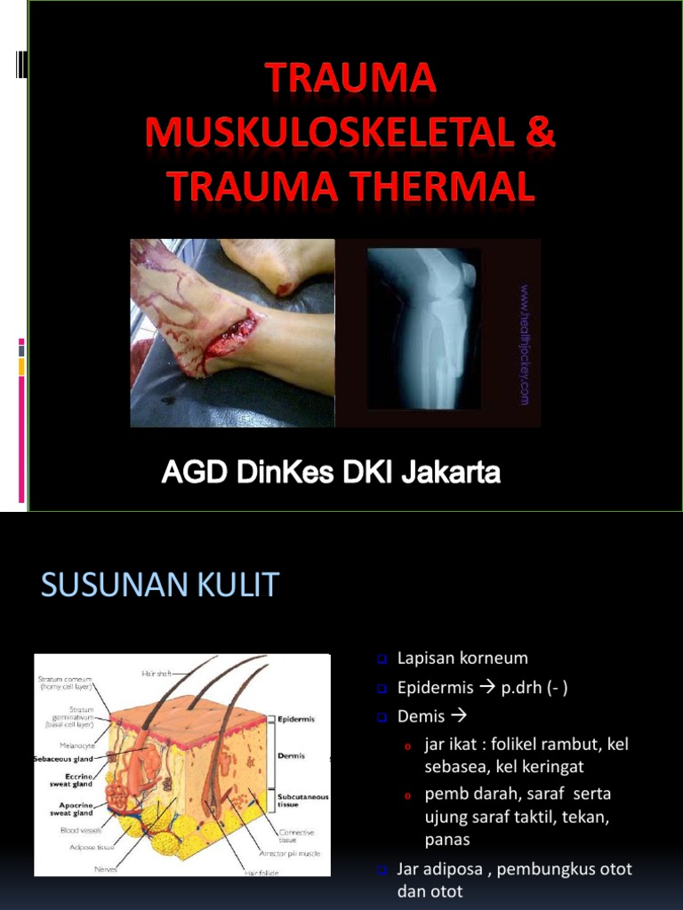 Trauma Thermal & Trauma Muskuloskeletal AFAMS | PDF