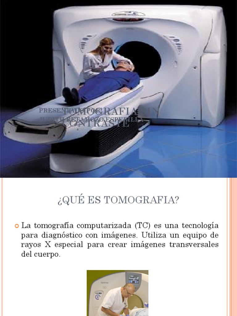 Tomografia Sin Contraste | PDF | Ct Scan | Enfermedades y trastornos