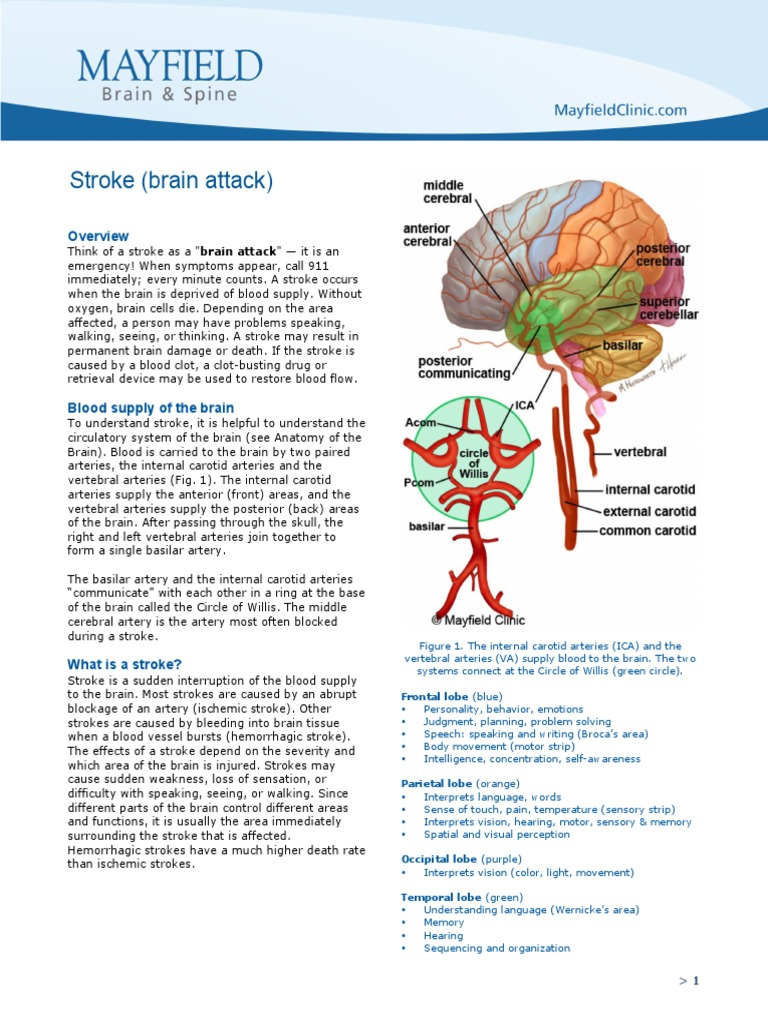 Stroke (Brain Attack) : Frontal Lobe (Blue) | Download Free PDF ...