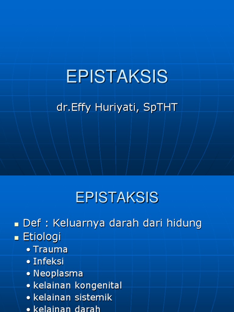 Epistaksis 160509020952 | PDF