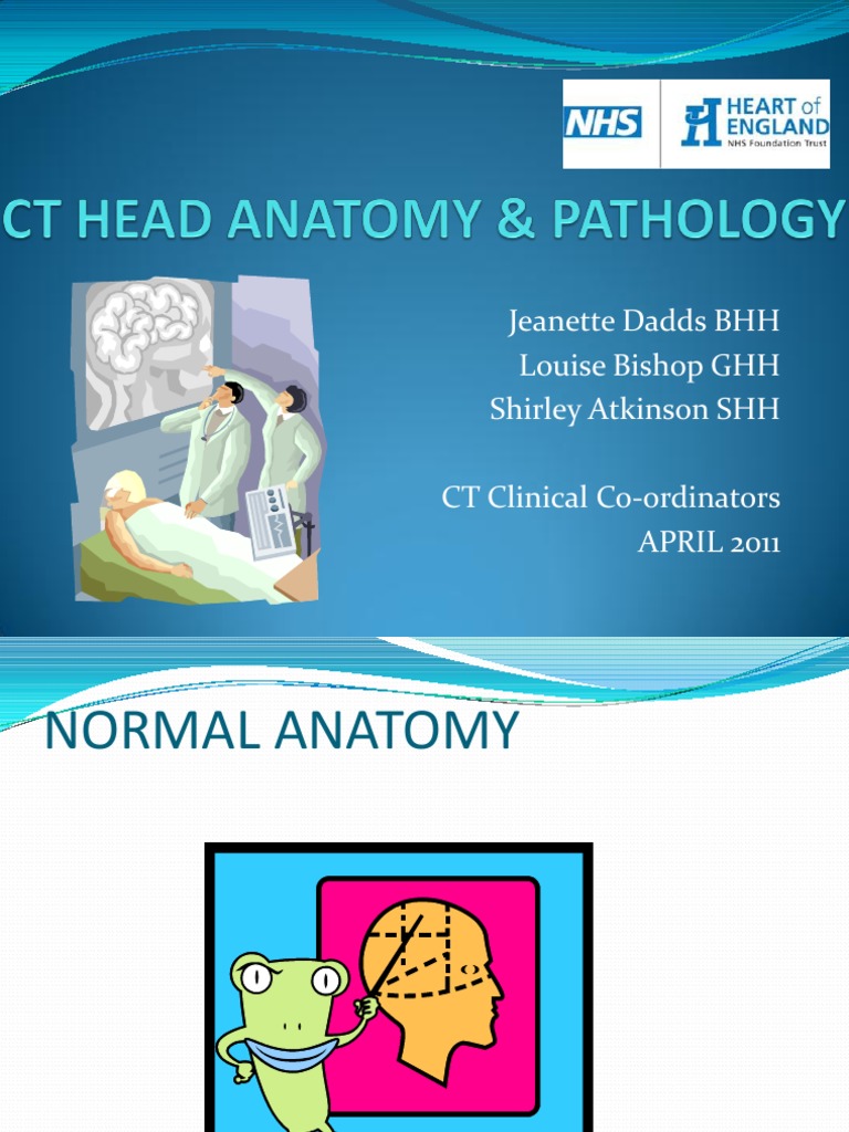 CT Head Anatomy & Pathology PDF | PDF