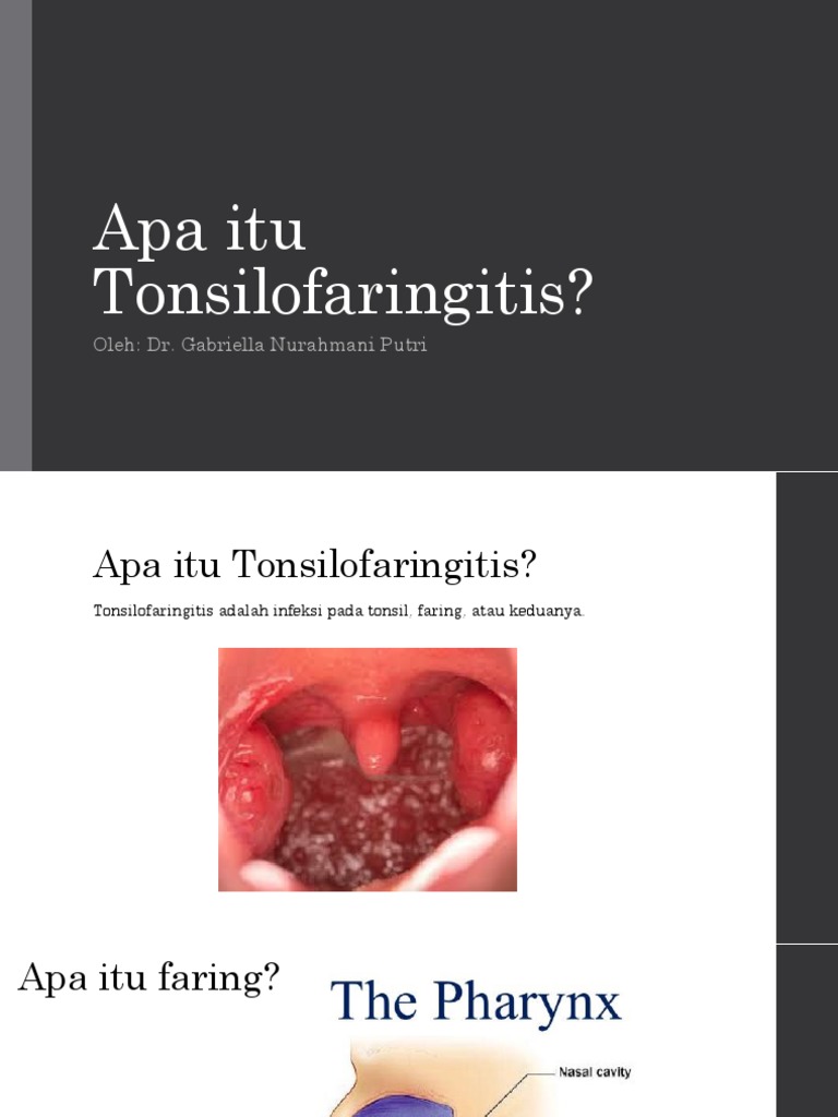 Tonsilofaringitis Penyuluhan | PDF