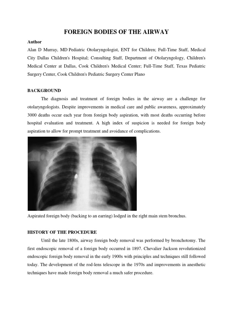 Airway Foreign Body Management in Children | PDF | Larynx | Respiratory ...