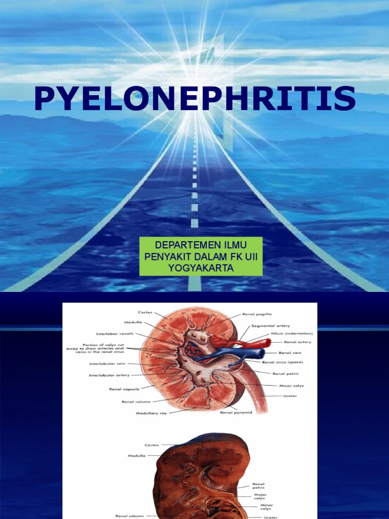 Pyelonephritis | Urinary Tract Infection | Kidney