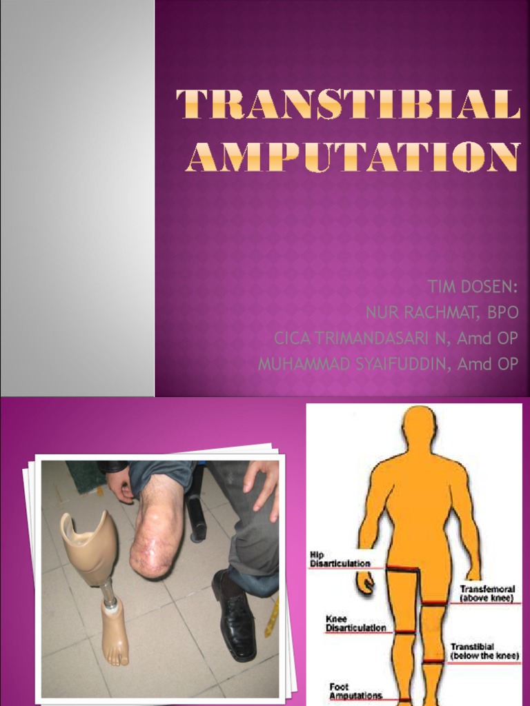 Transtibial Amputation | PDF | Amputation | Medicine
