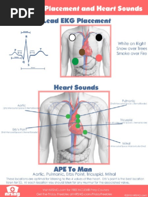 5 Lead Ecg Placement