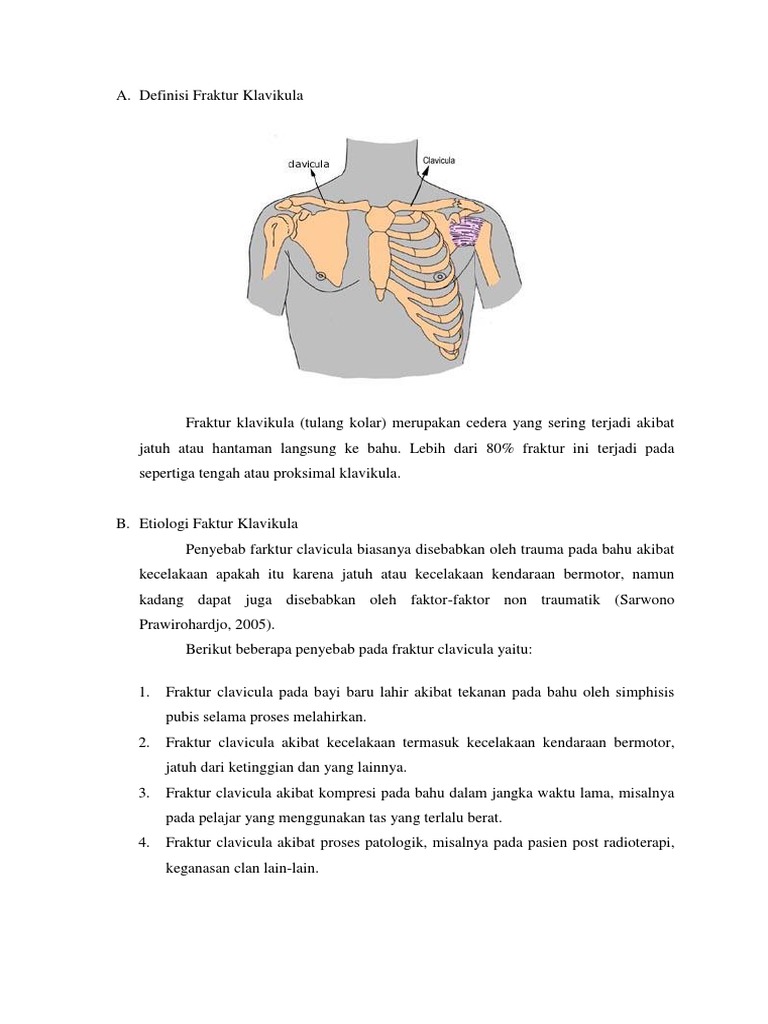 KLASIFIKASI DAN PENANGANAN FRAKTUR KLAVIKULA | PDF