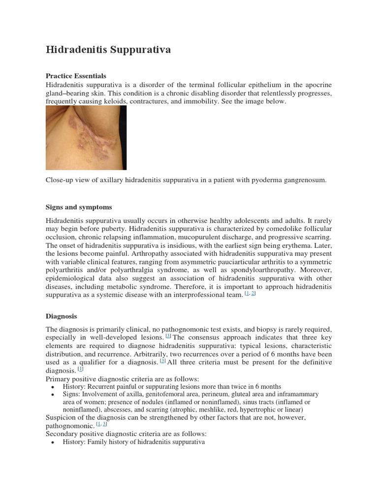 Hidradenitis Suppurativa | PDF | Clinical Medicine | Medicine