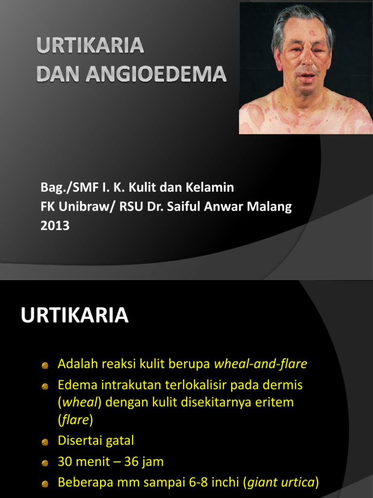 Urtikaria Dan Angioedema | PDF