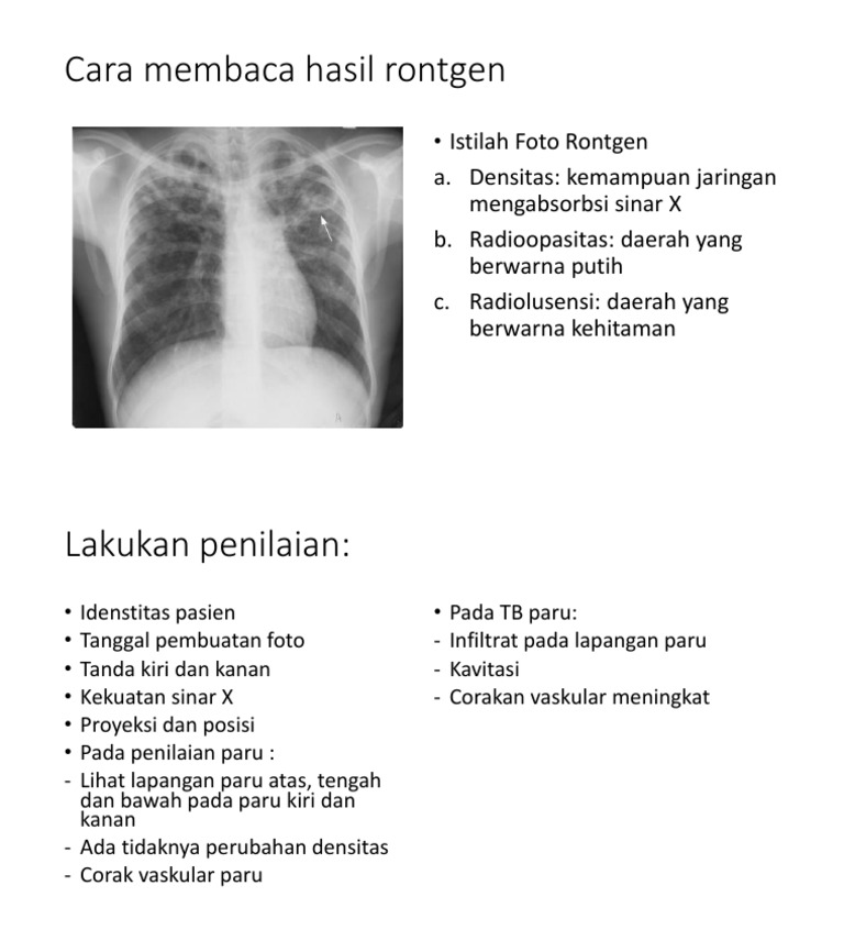 Cara Membaca Hasil Rontgen | PDF