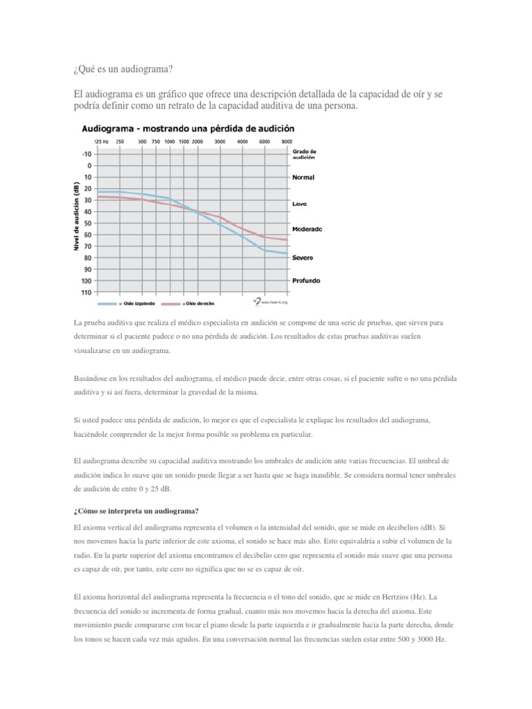 Qué Es Un Audiograma | PDF | Sonido | Decibel