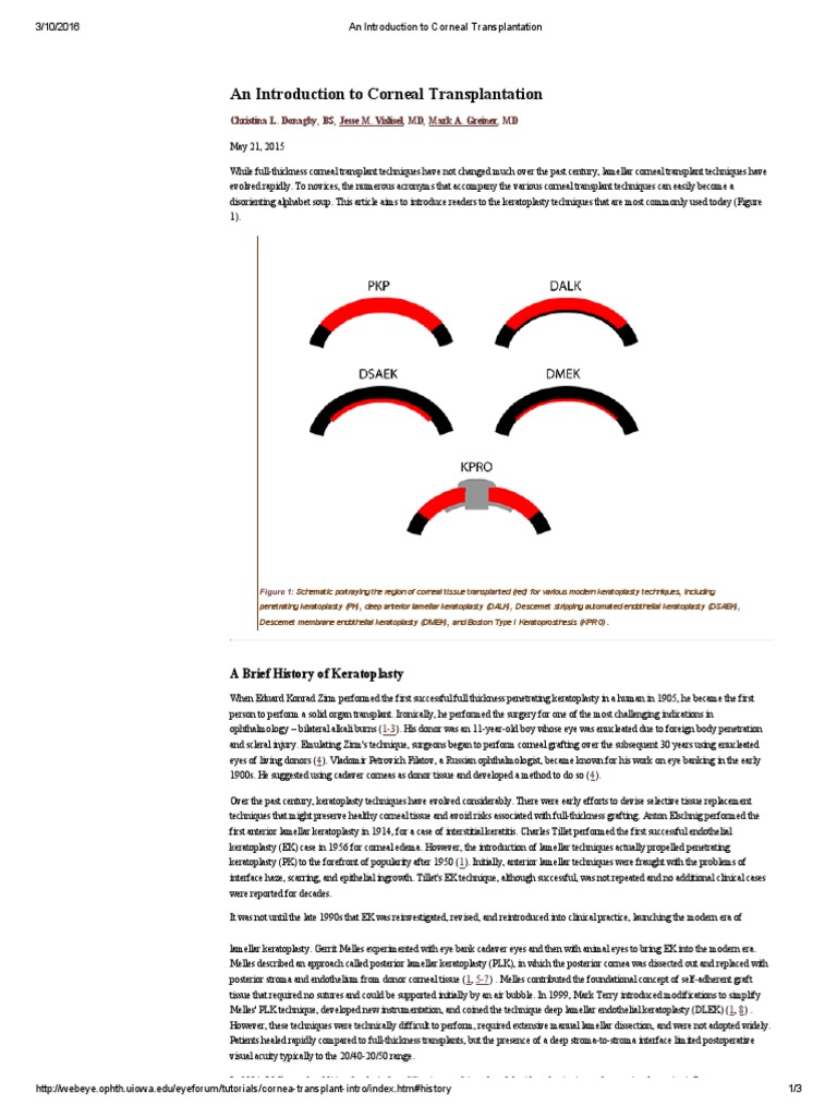 An Introduction to Corneal Transplantation | Cornea | Transplantation ...