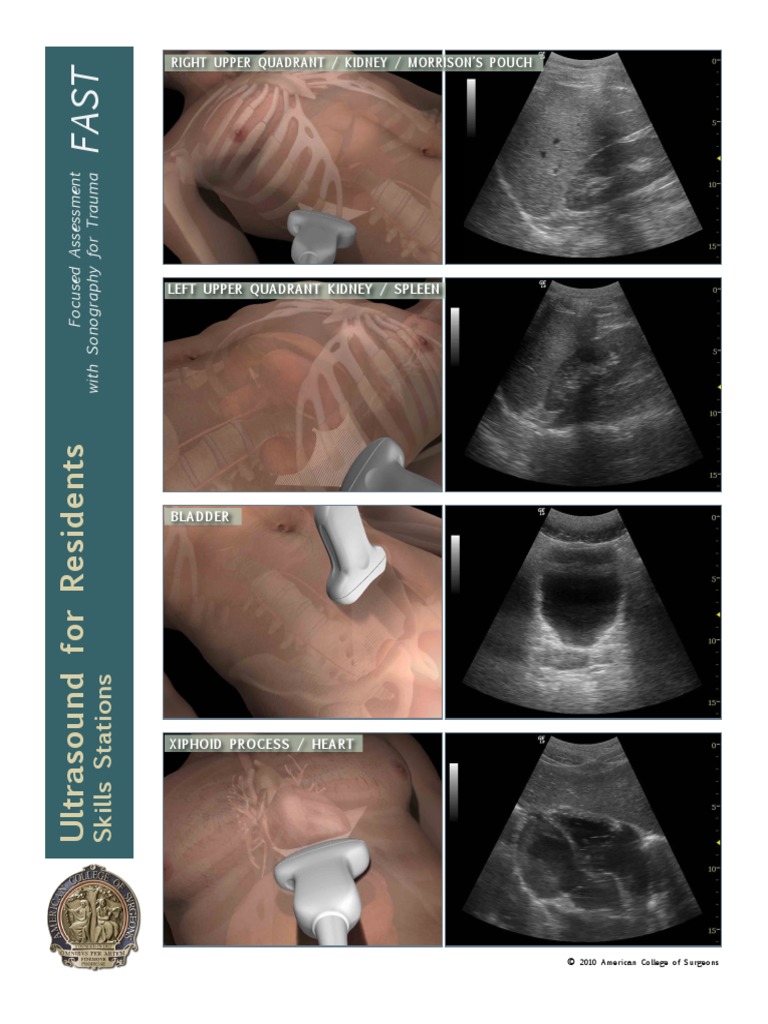 Right Upper Quadrant / Kidney / Morrison'S Pouch: 2010 American College ...