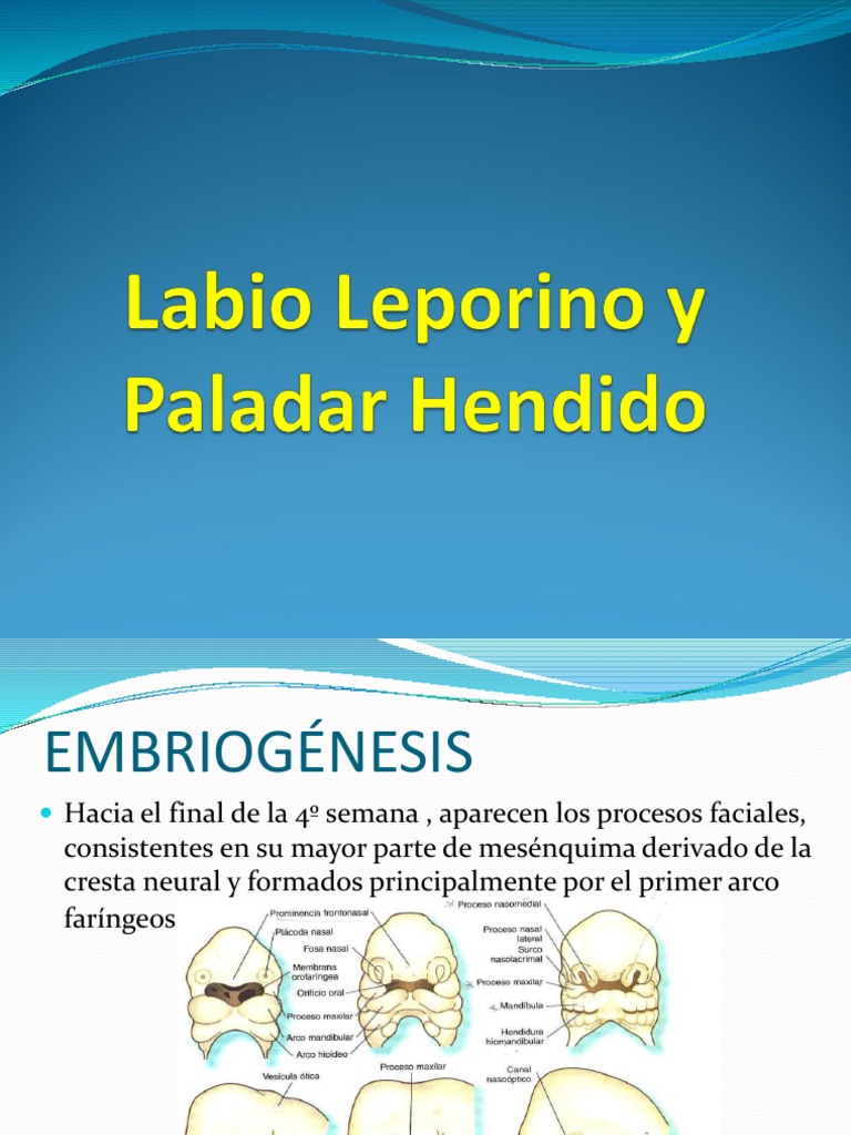 Labio Leporino | Especialidades médicas | Bienestar