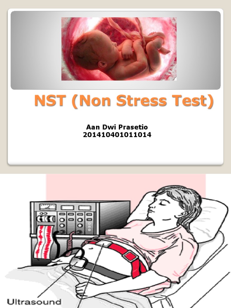 Panduan Non-Stress Test (NST) | PDF | Kesehatan Holistik
