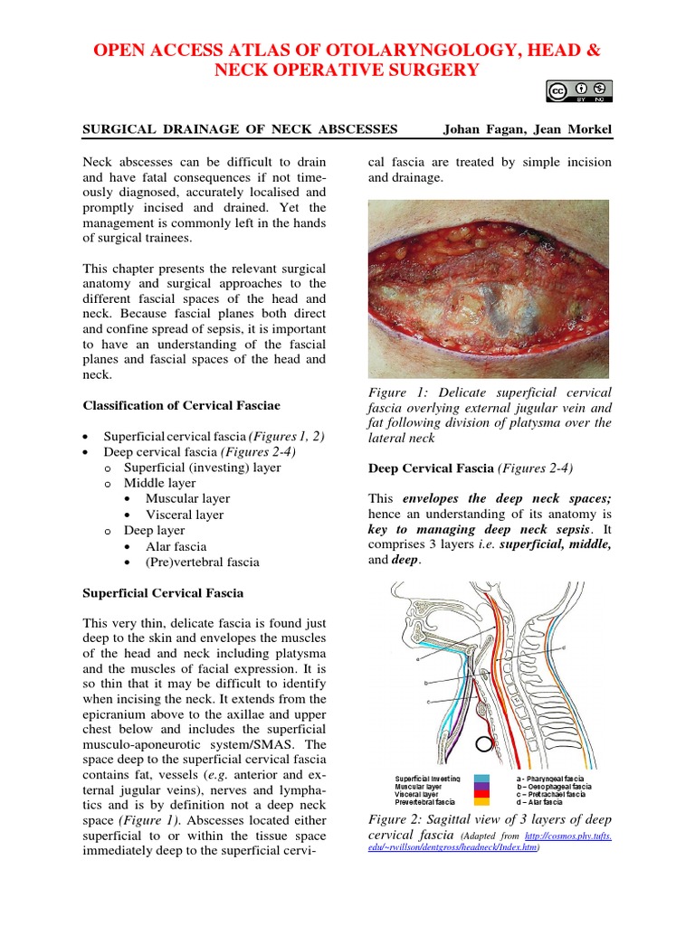 Surgical Drainage of Neck Abscesses | PDF | Common Carotid Artery | Neck
