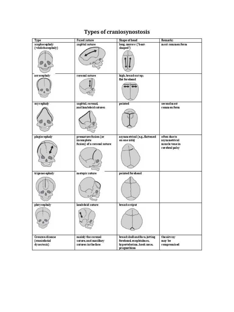 Types of Craniosynostosis | PDF | Animal Diseases | Musculoskeletal ...