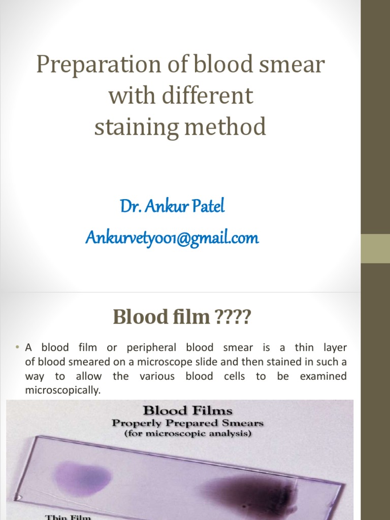 Preparation of Blood Smear With Different Staining Method: Dr. Ankur ...