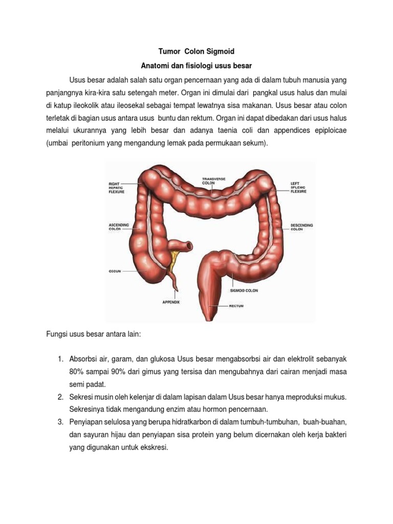 Tumor Colon Sigmoid | PDF