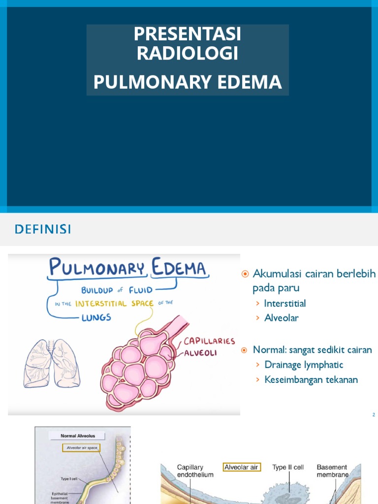 Edema Paru Radiology | PDF | Edema | Lung