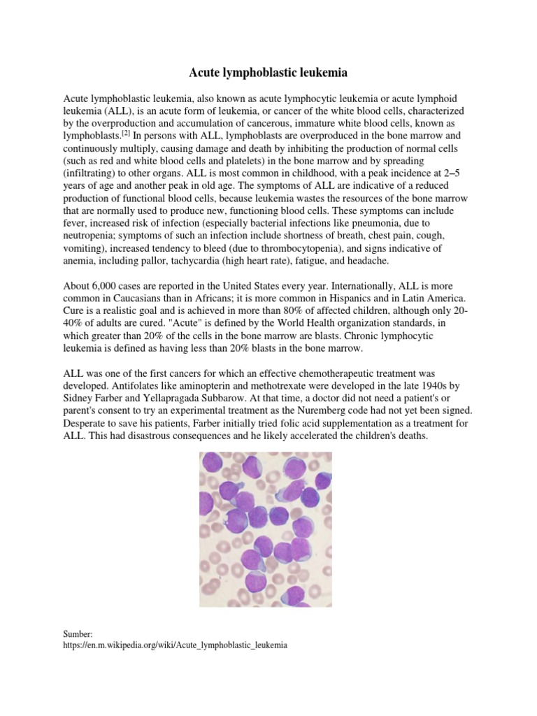 Acute Lymphoblastic Leukemia | PDF