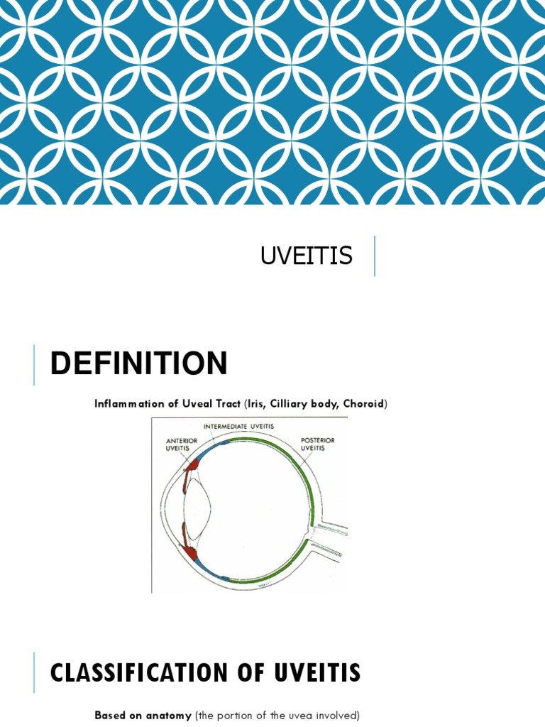 Uveitis | Epidemiology | Ophthalmology