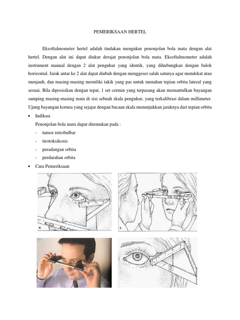 Pemeriksaan Eksoftalmometer Hertel | PDF | Pengembangan Diri | Sains ...