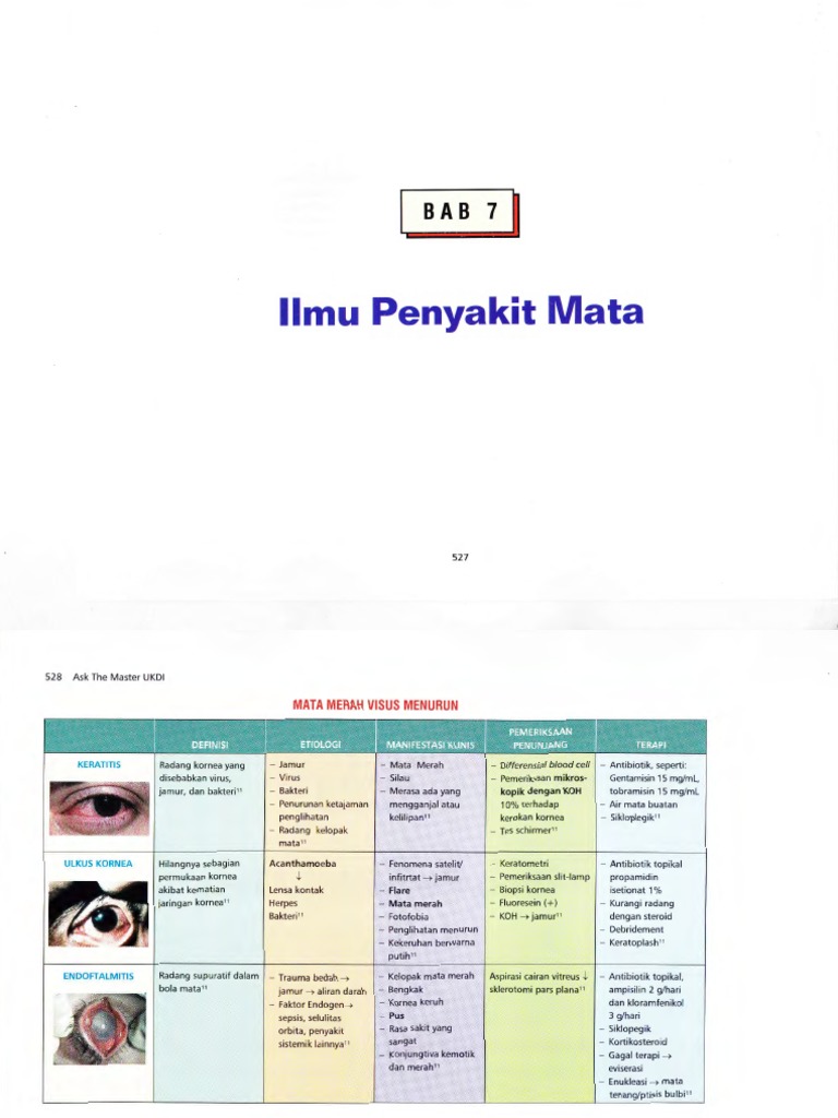 Bab 07. Ilmu Penyakit Mata | PDF