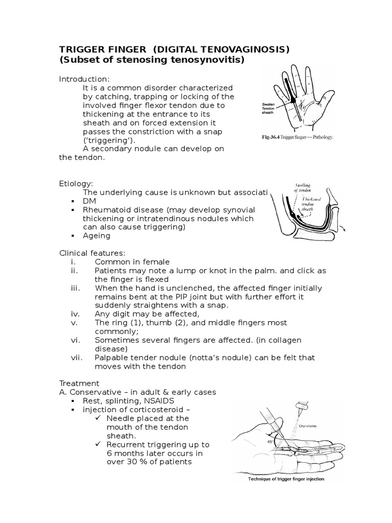 Trigger Finger (Digital Tenovaginosis) (Subset of Stenosing ...