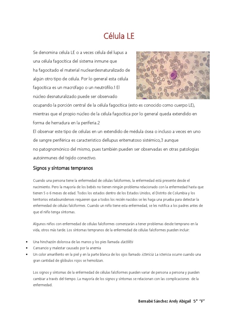 Célula LE | PDF | Lupus eritematoso sistémico | Inmunología