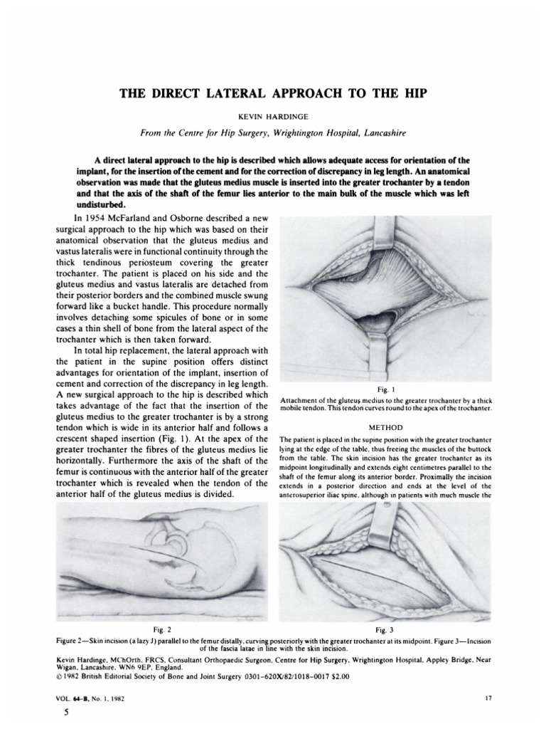 The Direct Lateral Approach To The Hip Jbjs BR | PDF | Anatomical Terms ...