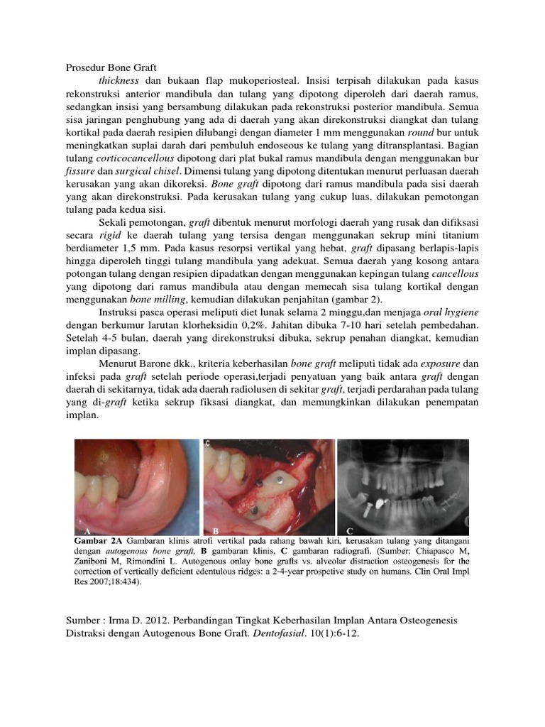 Prosedur Bone Graft | PDF