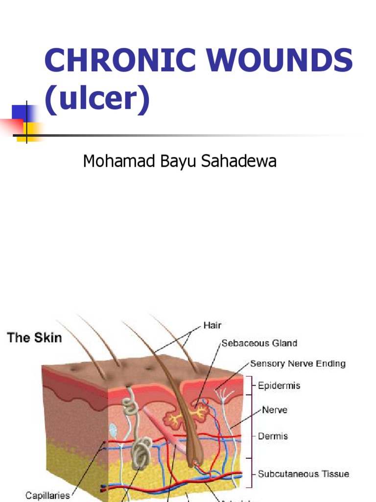 Chronic Wound Management Overview | PDF | Wound Healing | Diseases And ...