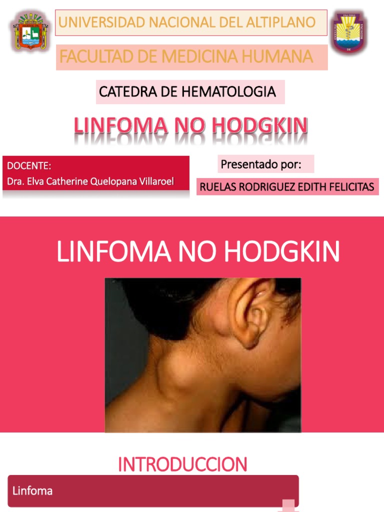 Linfoma No Hodgkin | PDF | Linfoma | Cáncer