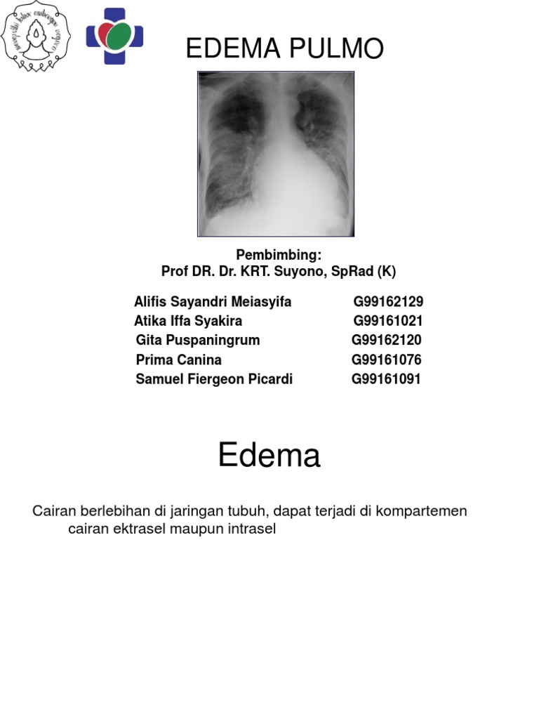 Edema Pulmo | PDF | Sains & Matematika
