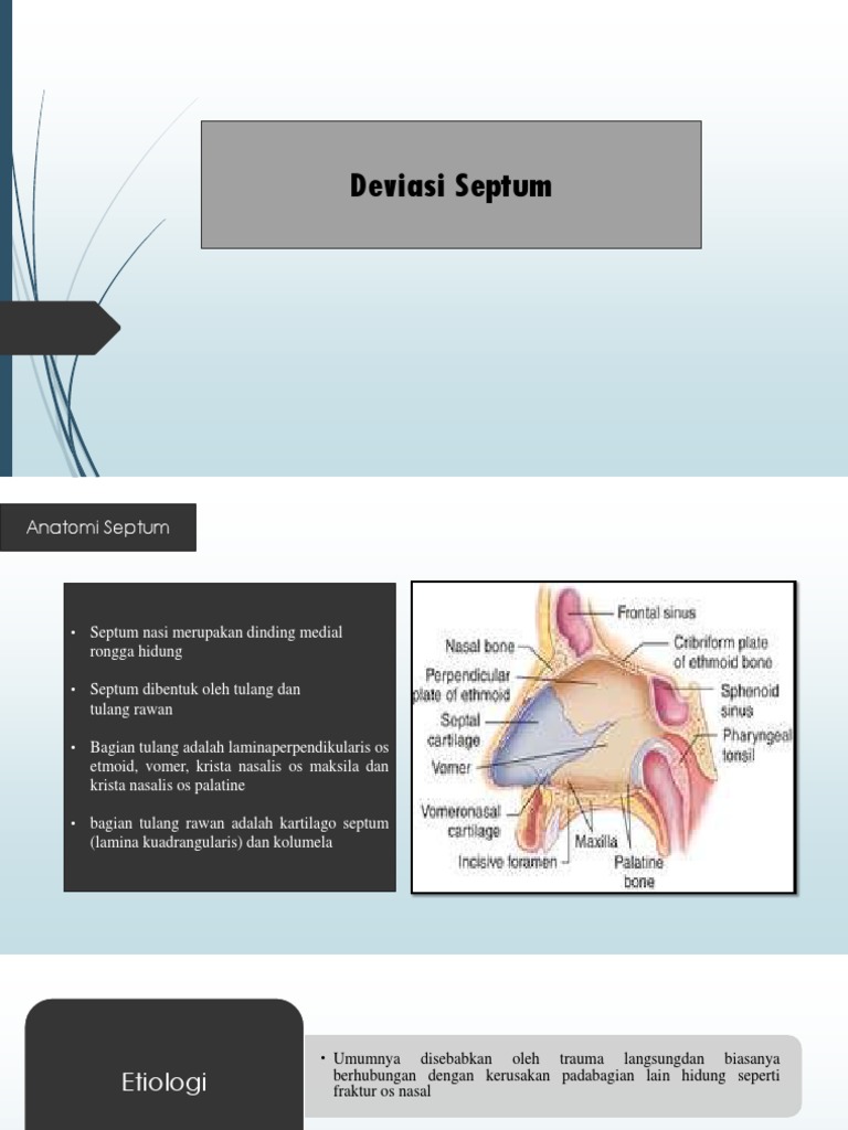 Deviasi Septum | PDF
