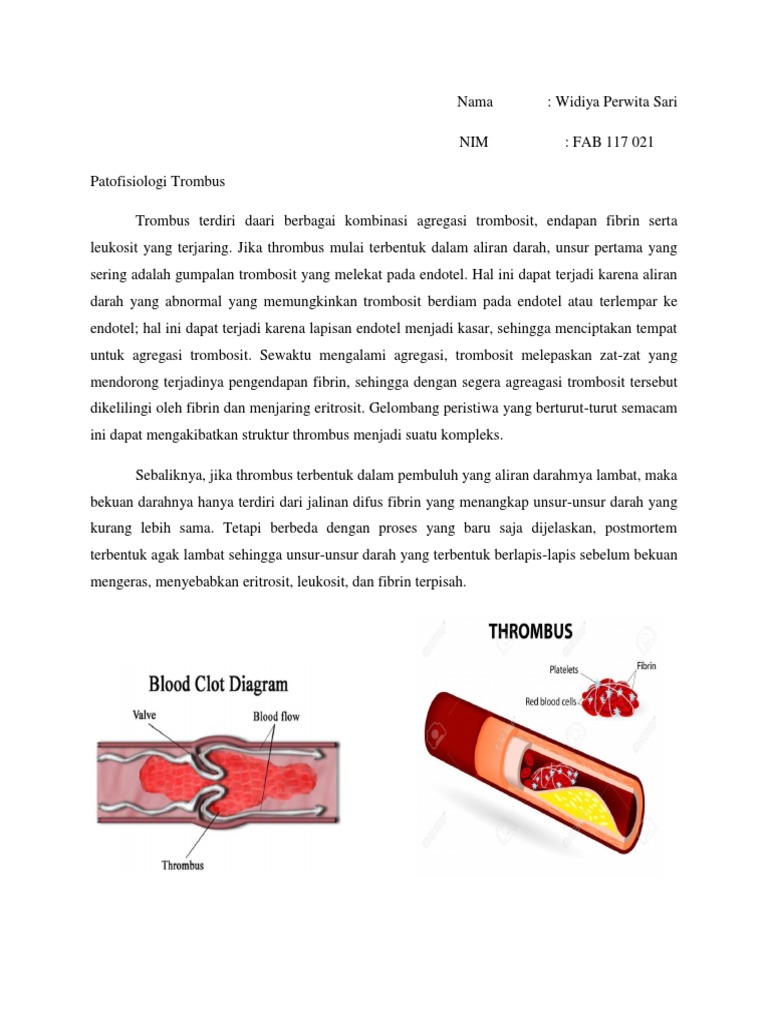 Patofisiologi Trombus | PDF