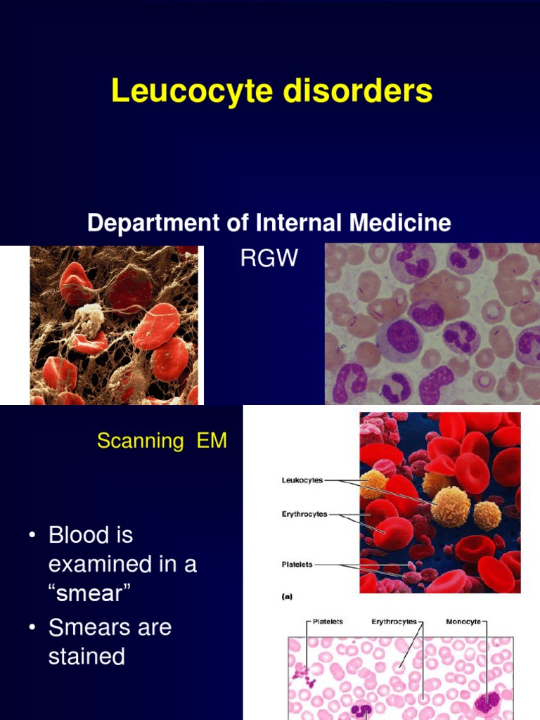 Leukocyte Disorders | PDF | White Blood Cell | Leukemia
