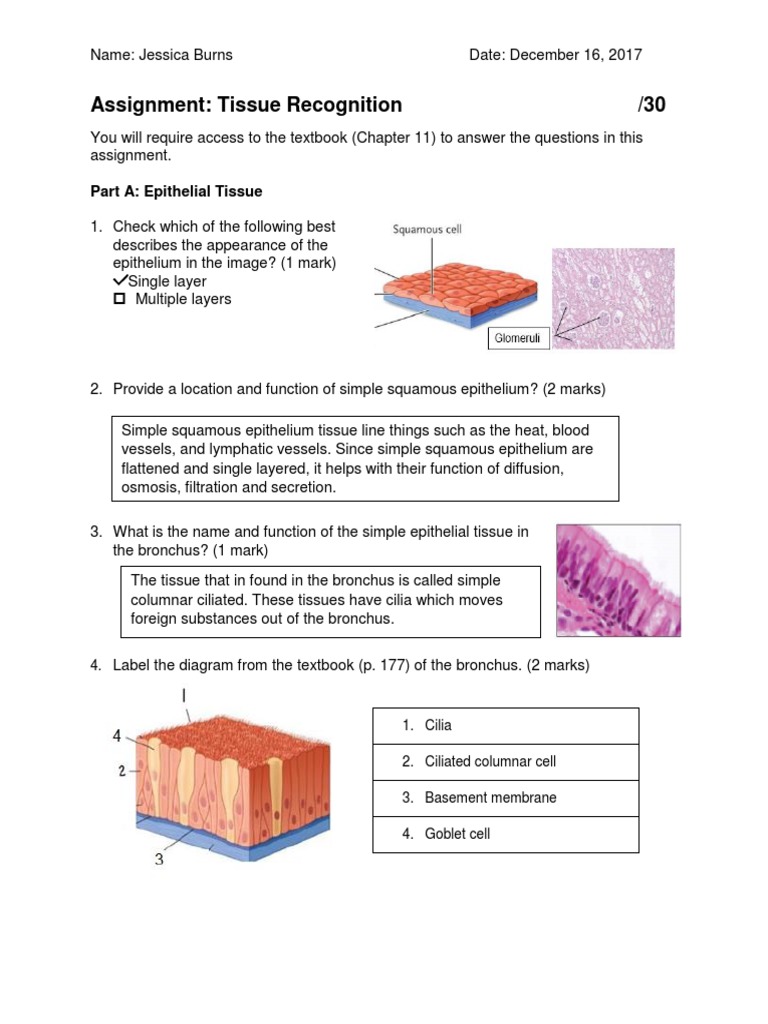 Assignment: Tissue Recognition /30: Part A: Epithelial Tissue | PDF ...