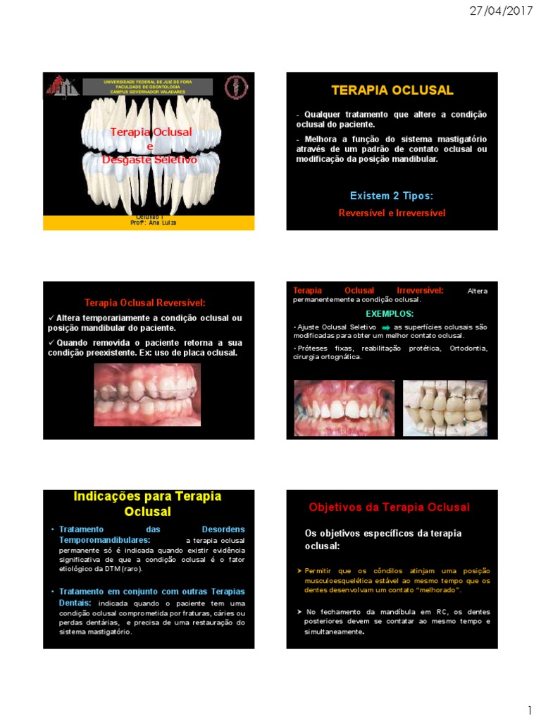 Ajuste Oclusal. Desgaste Seletivo Modificado | PDF | Dente | Ortodontia