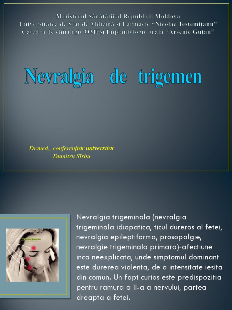 Prelegere Nevralgia de Trigemen | PDF