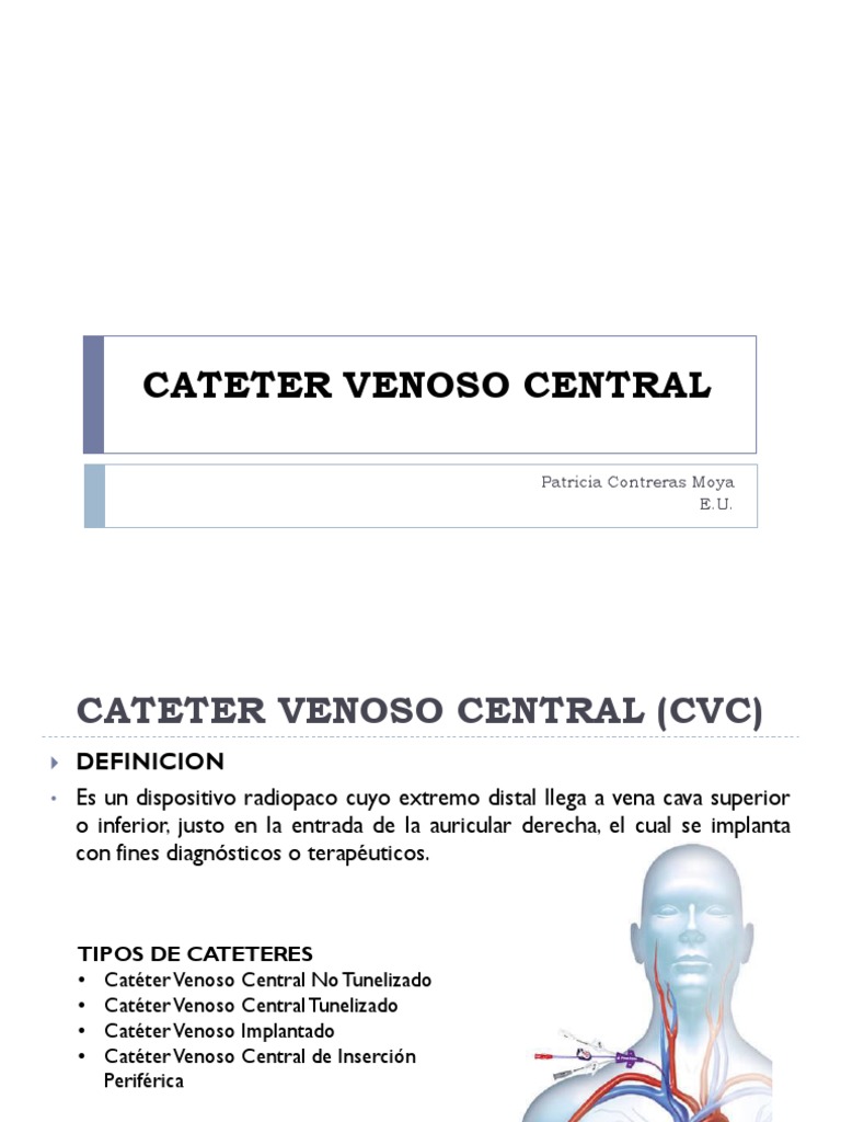 Tipos y cuidados del catéter venoso central | PDF | Terapia intravenosa ...
